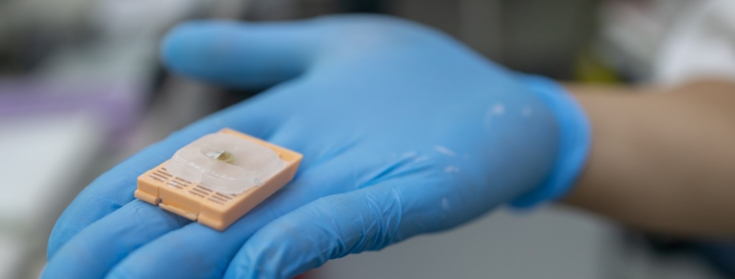 Bioecho Introduces Echolution™ Ffpe Rna Kit For Superior Rna Extraction